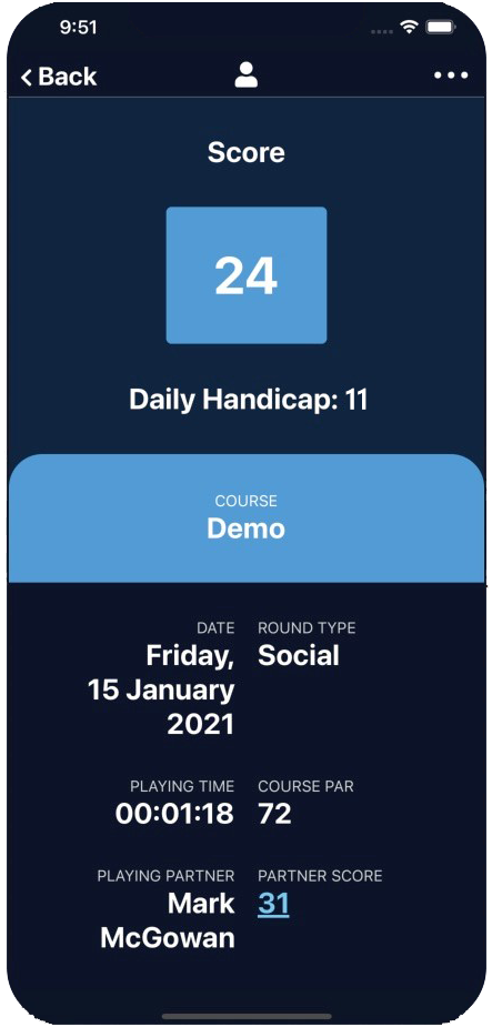New MiScore History Feature - MiScore